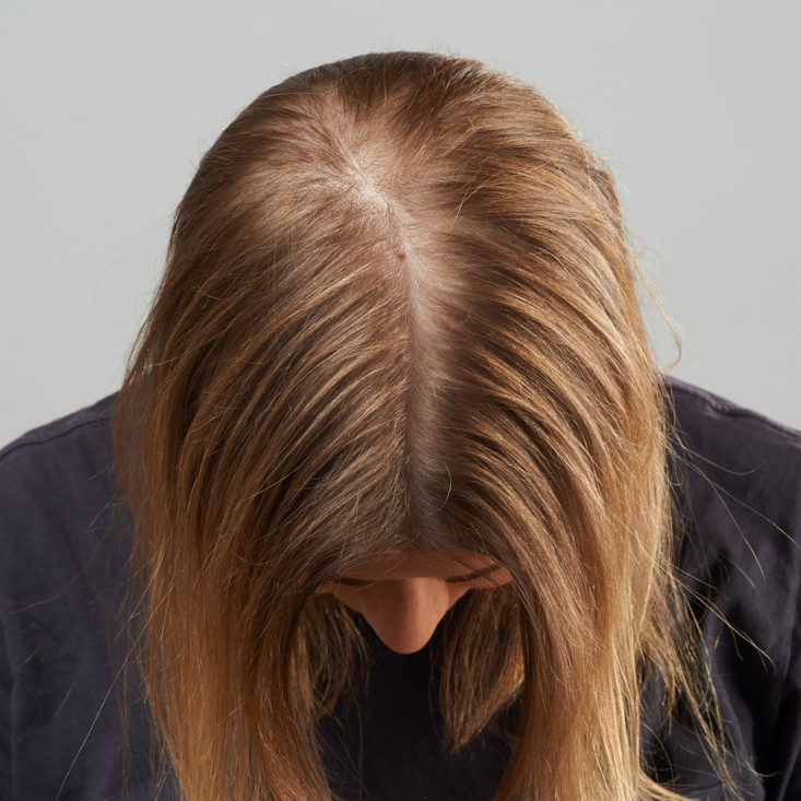 Hers Review: A Hair Loss Solution for Women? | MSA