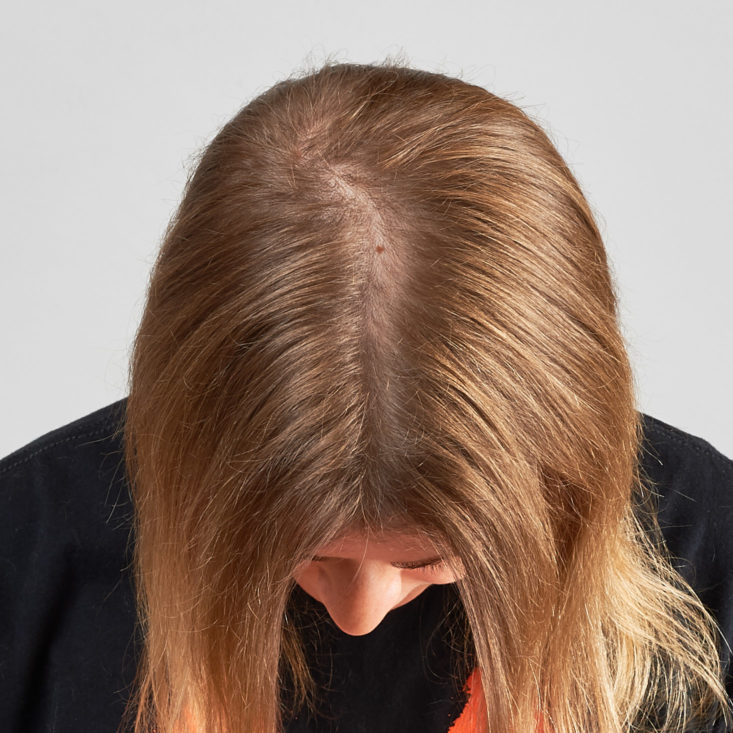 Hers Review: A Hair Loss Solution for Women? | MSA