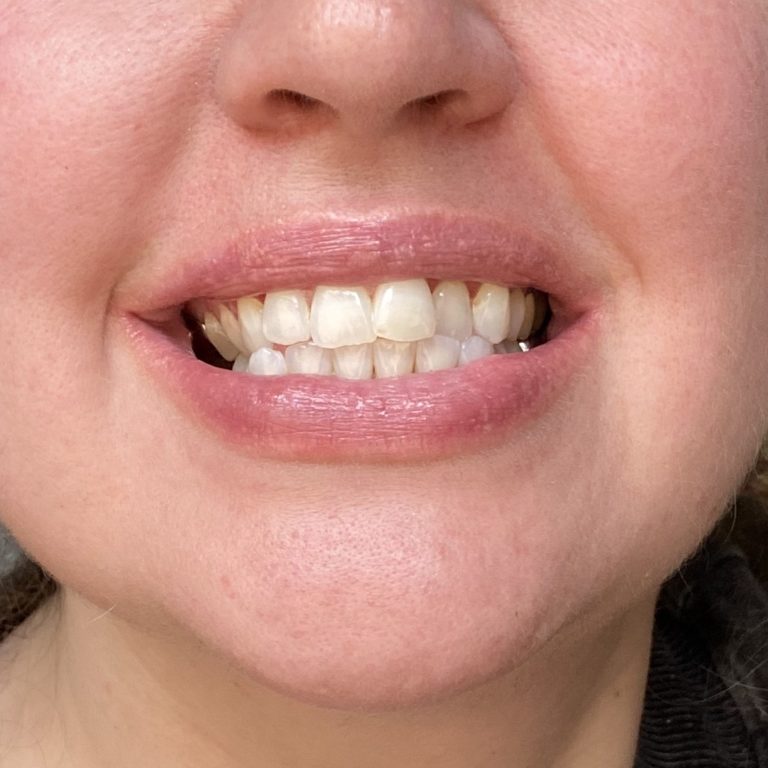 BoxyLuxe Subscription Box Review - December 2020 | MSA