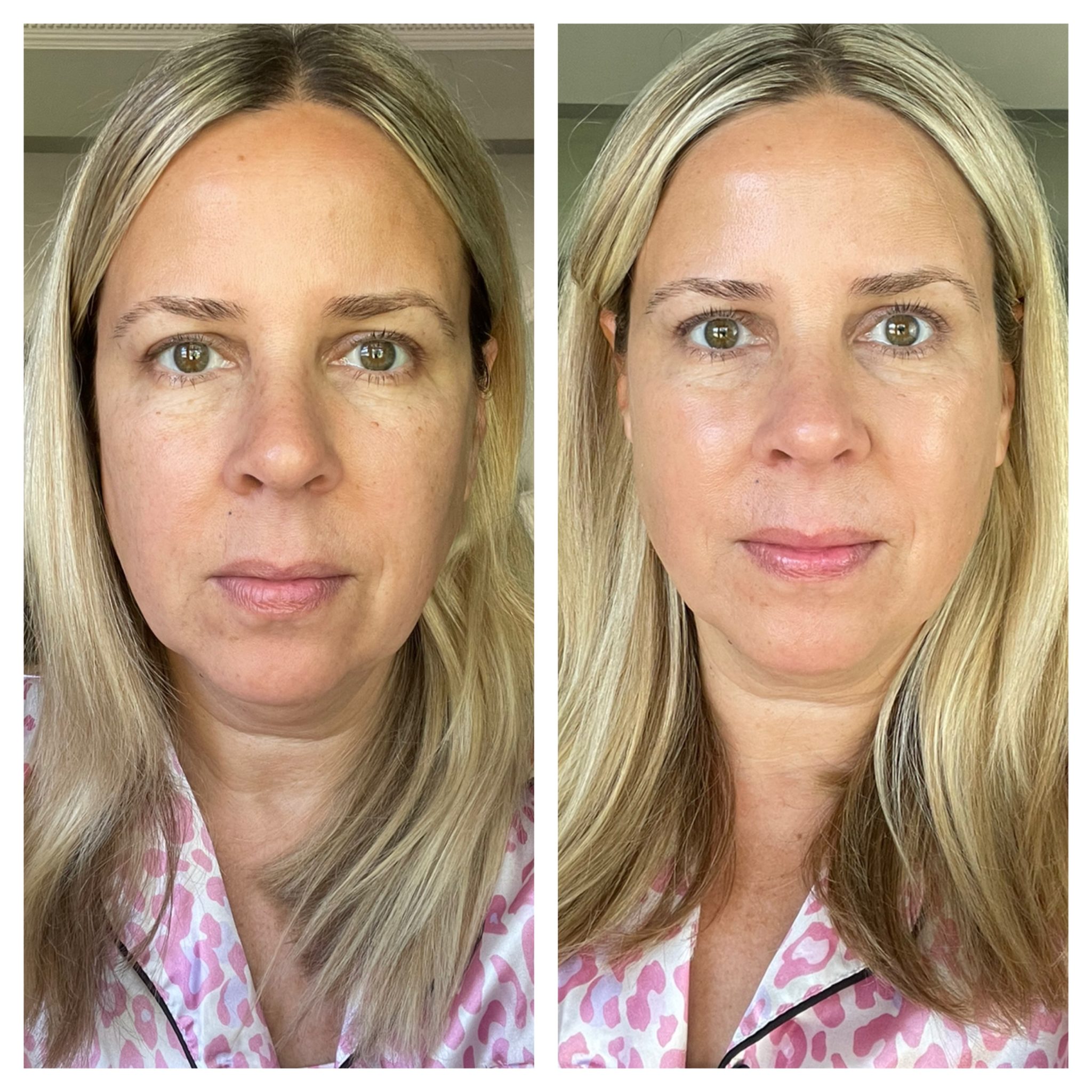 That Time TikTok Got It Right – The Facial Wand That Was Actually as ...