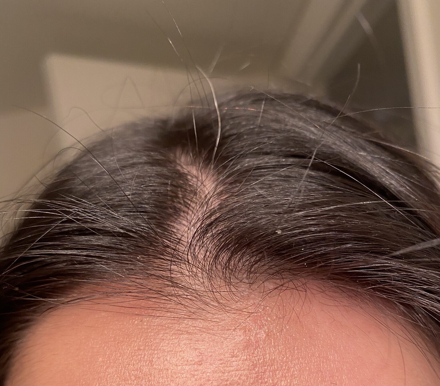 Arey vs. Hey Hair vs. Hair Mayraki: Which is the Superior Hair Care ...